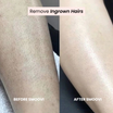 Smoovi 2.0 Bikini Shaver – Bgins Beauty